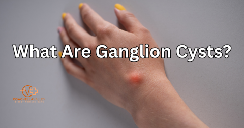 Understanding the Causes of Ganglion Cysts - Coachella Valley Direct ...